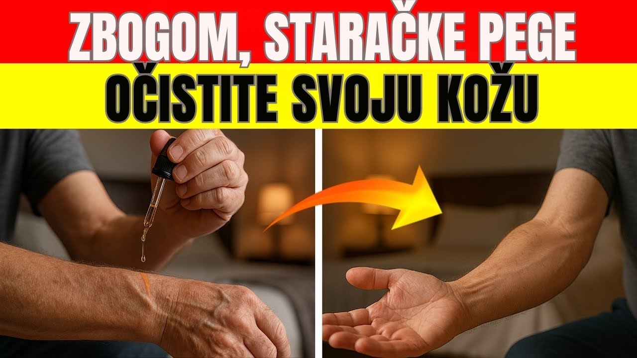 Dermatolozi Šokirani: Ovaj Jeftini Sastojak BRIŠE Mrlje Na Rukama ...