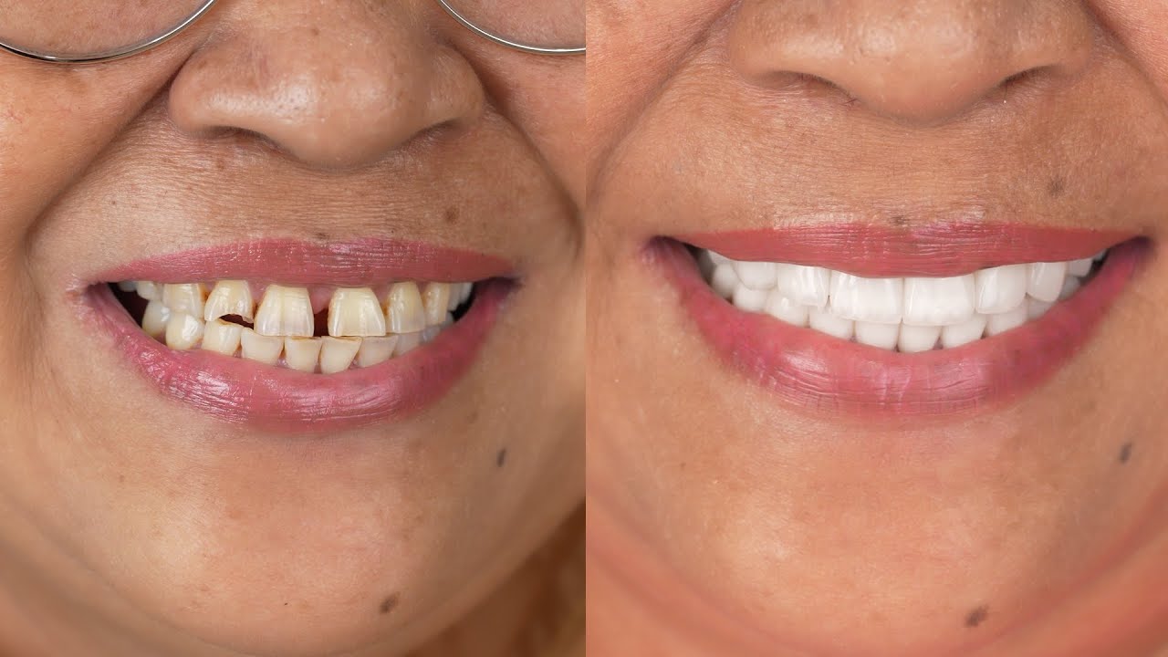 Ms. Flynn's New Smile | Dr. RFD - YouTube