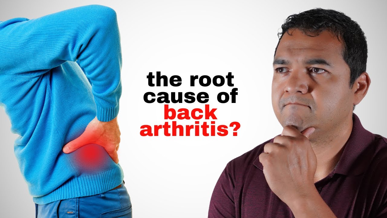 Understanding and Addressing the Root Cause of Back Arthritis: A ...