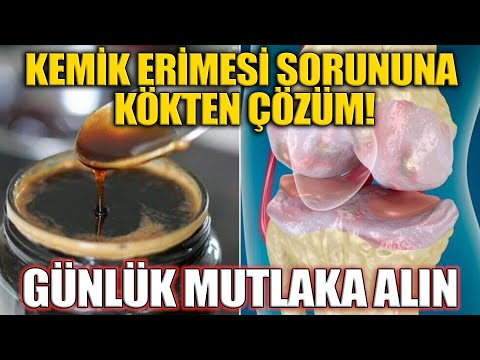 Kemik Erimesi Sorununa Kökten Çözüm! Günlük Mutlaka Alın!