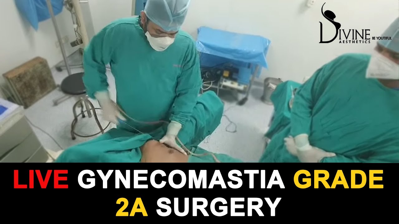 Live Gynecomastia Grade 2A Surgery - YouTube