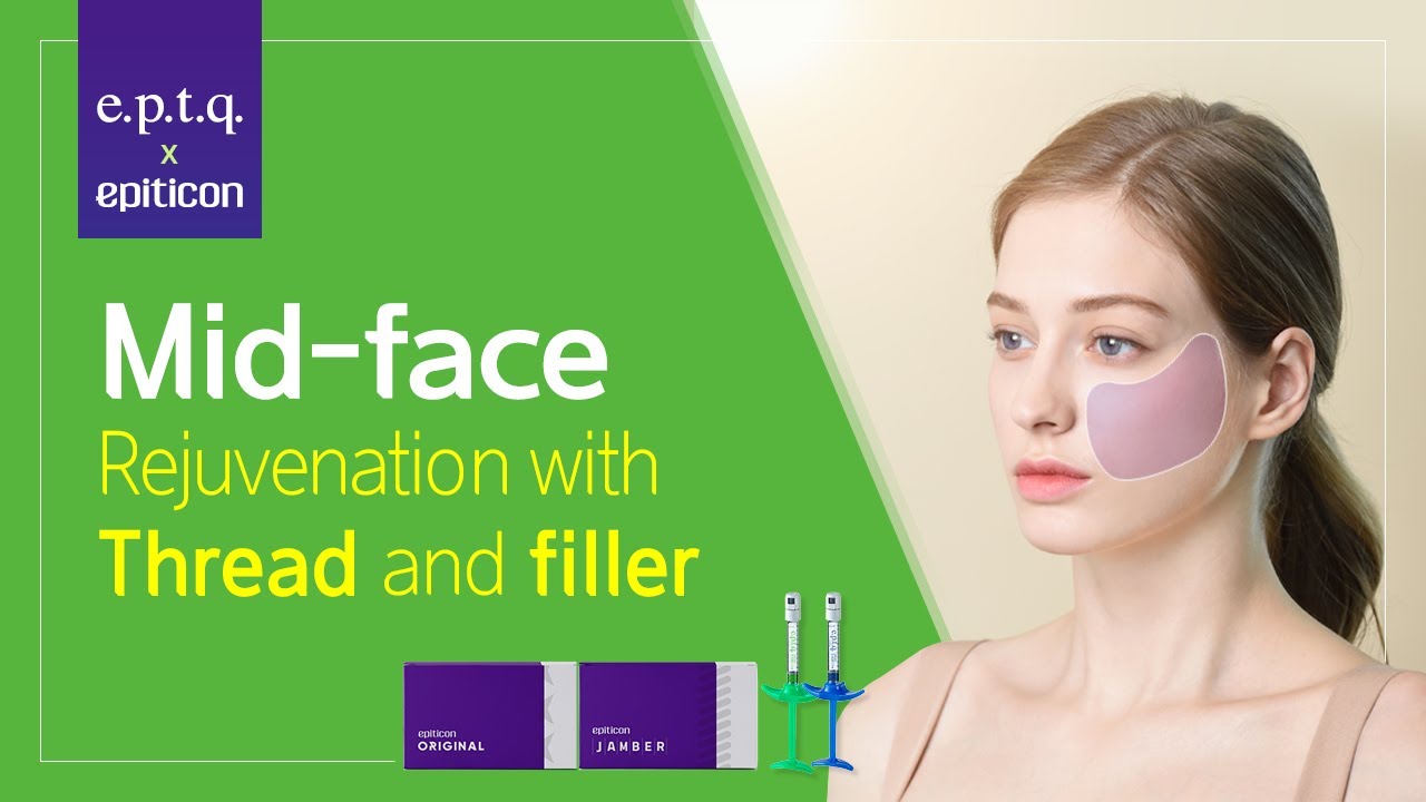 Mid-face rejuvenation with epiticon thread and e.p.t.q. filler - YouTube