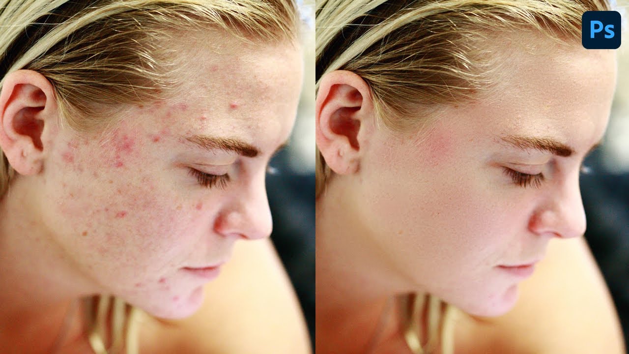 Photoshop Tutorial: How to Quickly Remove Blemishes & Scars - YouTube