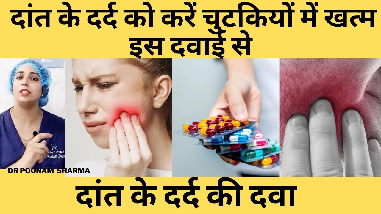 दांत में तेज दर्द हो तो कौनसी दवाई लेनी चाहिए ? Medicines For Severe ...