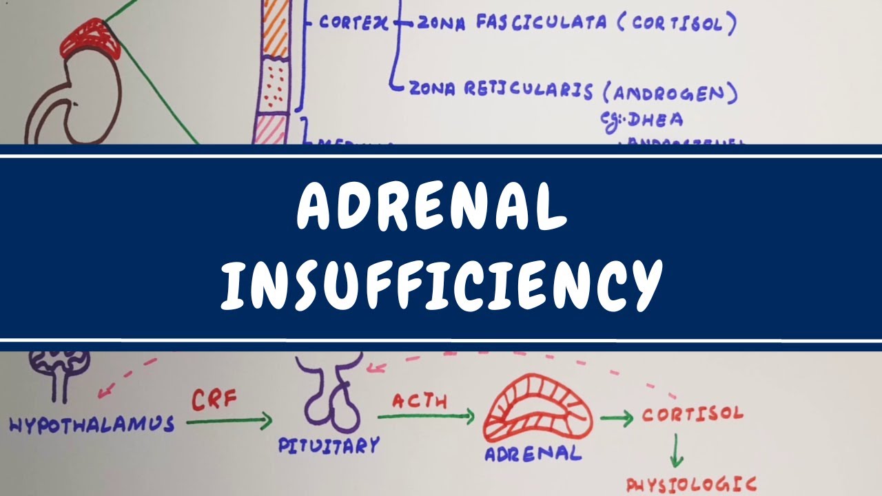 Adrenal Insufficiency made easy (Pathophysiology, causes, symptoms ...