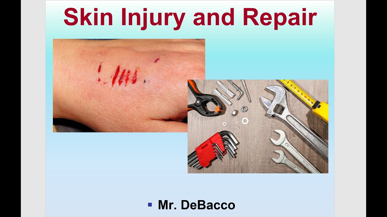 Skin Injury and Repair - YouTube