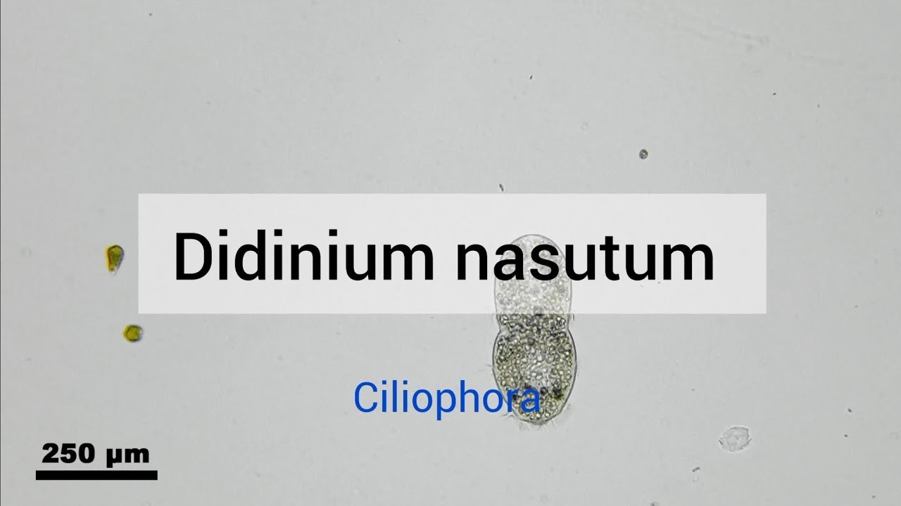 Didinium nasutum (Ciliophora) - YouTube