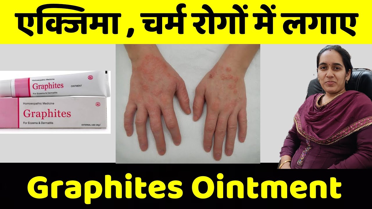 Graphites ointment homeopathic medicine uses | Ointment Cream for ...