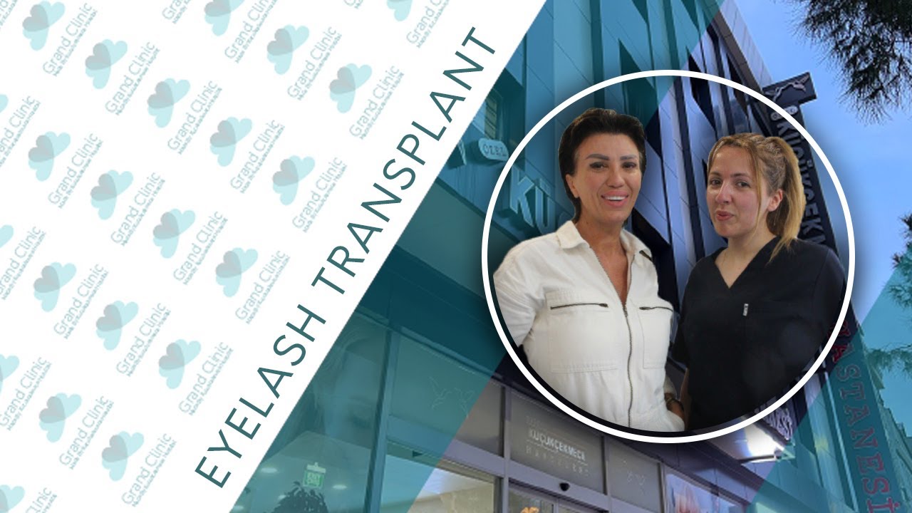 Eyelash Transplant Procedure - Grand Clinic - YouTube
