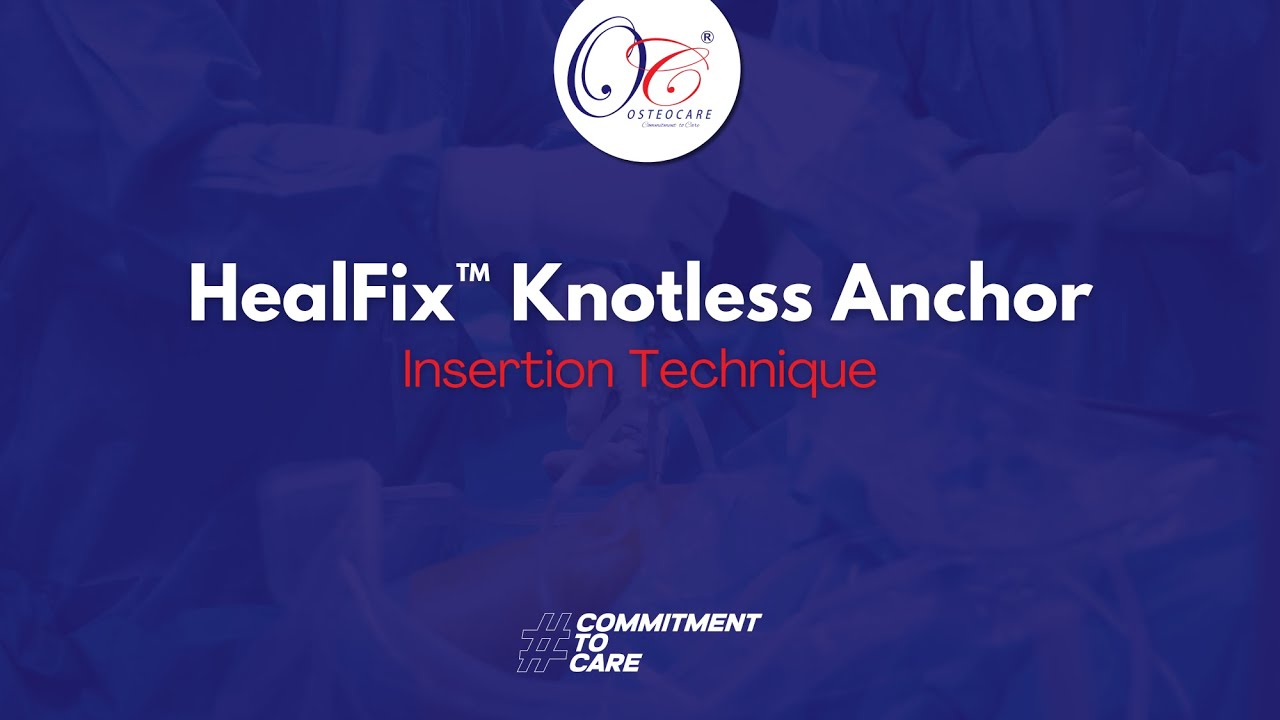 HealFix™ Knotless Anchor | Insertion Technique - YouTube