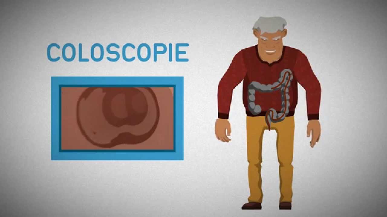 Dikkedarmkanker: bevolkingsonderzoek - YouTube