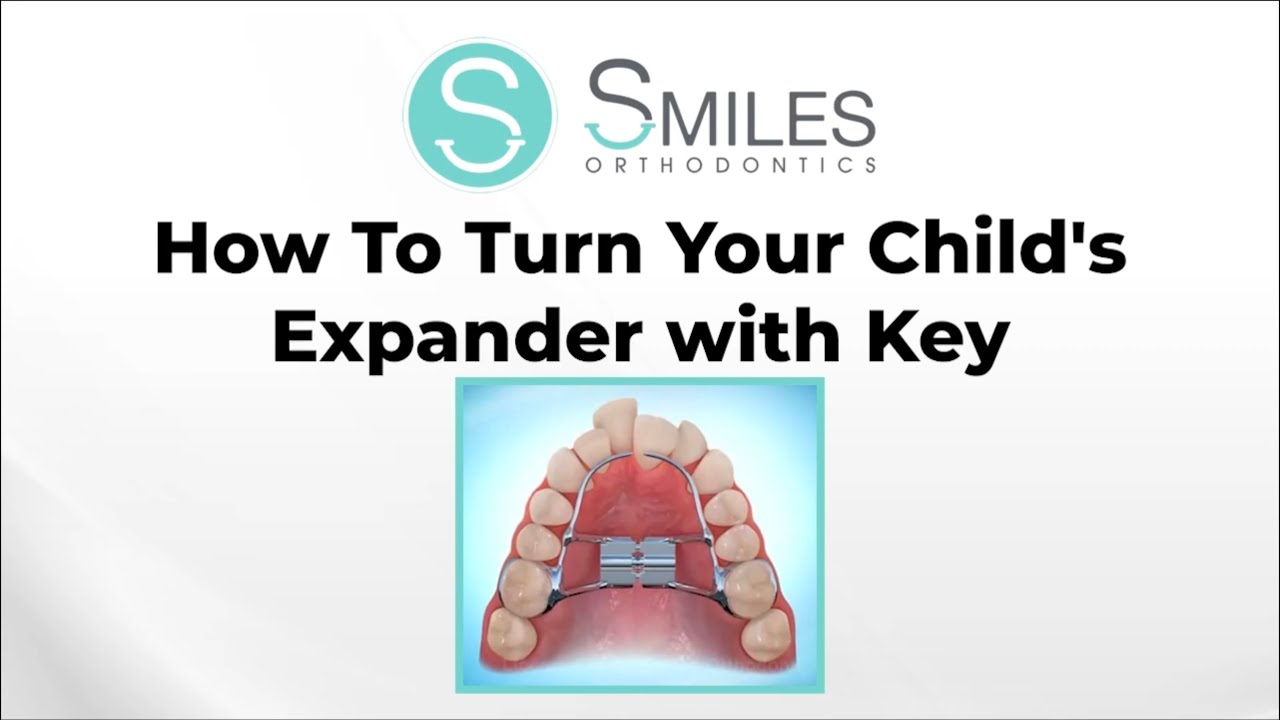 How To Turn Your Child's Expander with Key - An Instructional Video ...