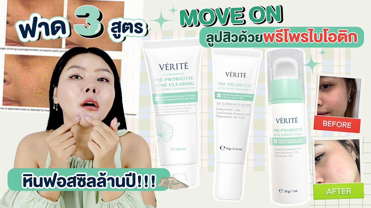 (กูรูเช็ค) 3 สูตรจากแบรนด์ VERITE มูฟออนลูปสิว เคลียร์ทุกจุด กับส่วนผสม ...