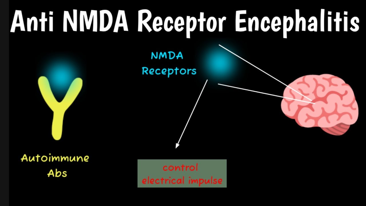 Anti NMDA | Anti NMDA Receptor Encephalitis | - YouTube