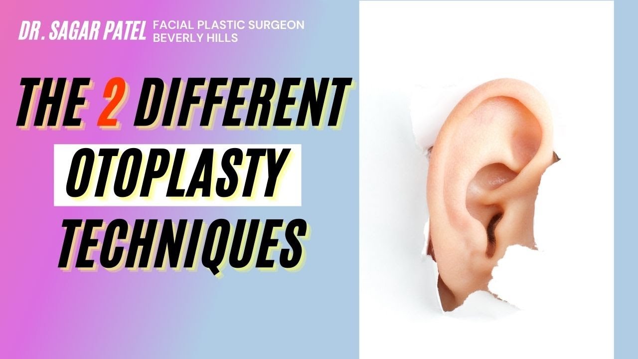 The 2 Different Otoplasty Techniques! - YouTube