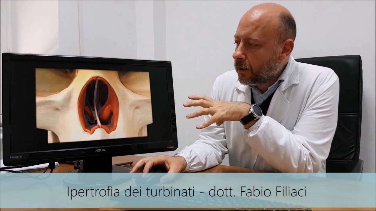 Disturbi della respirazione da turbinati nasali ipertrofici - YouTube