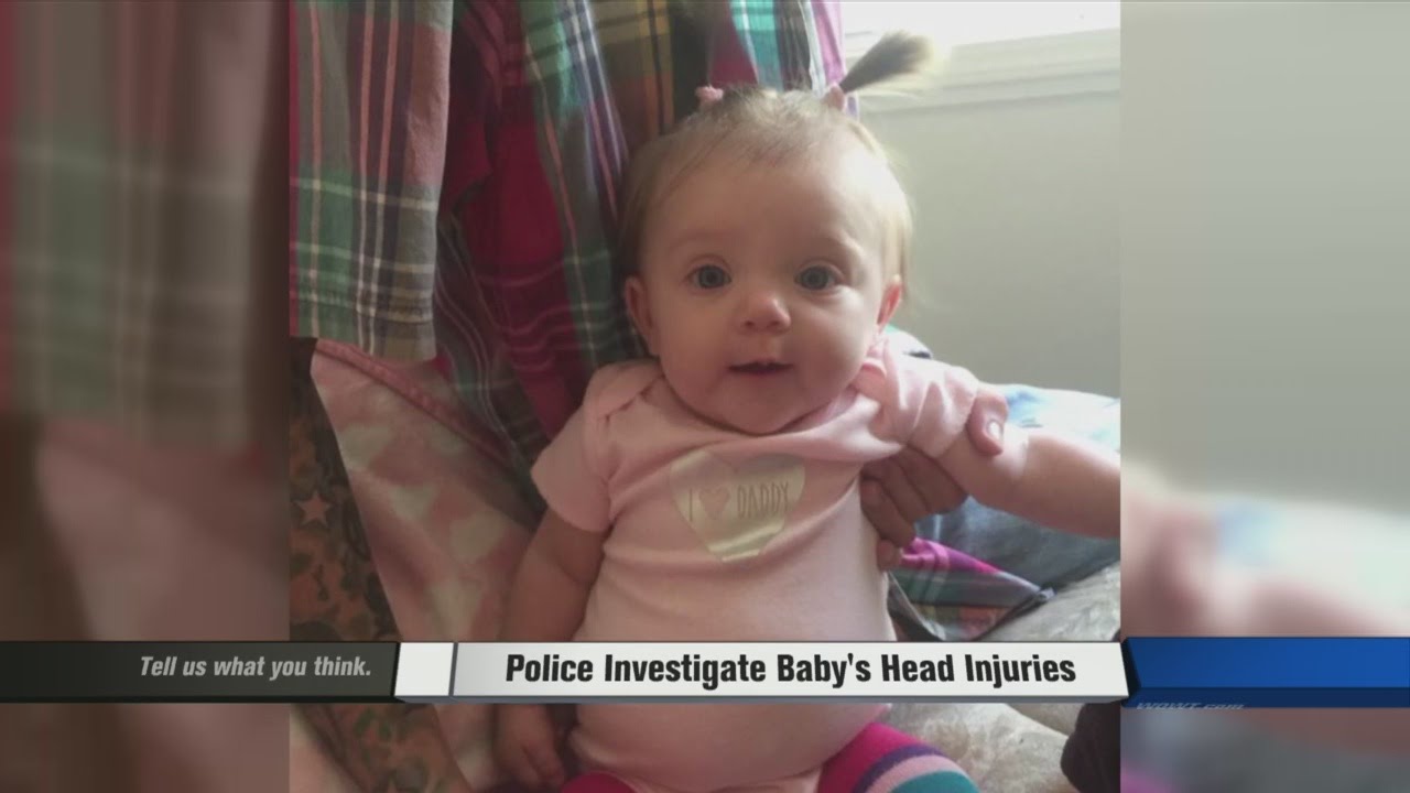 Baby Treated for Head Injuries - YouTube