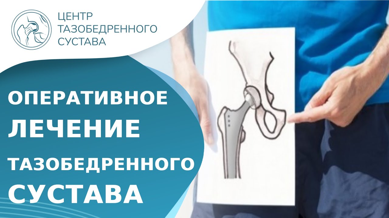 🦿 Операция тотального эндопротезирования тазобедренного сустава