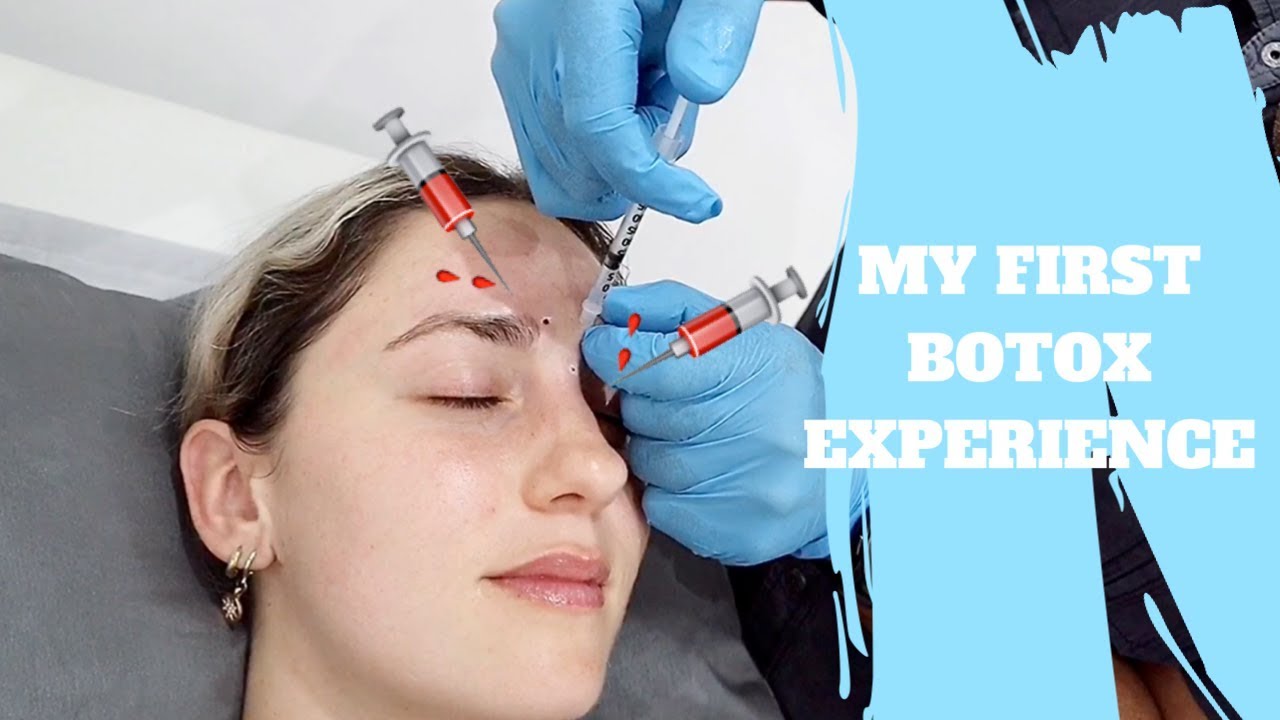 MY FIRST BOTOX EXPERIENCE!! | Botox Q&A - YouTube