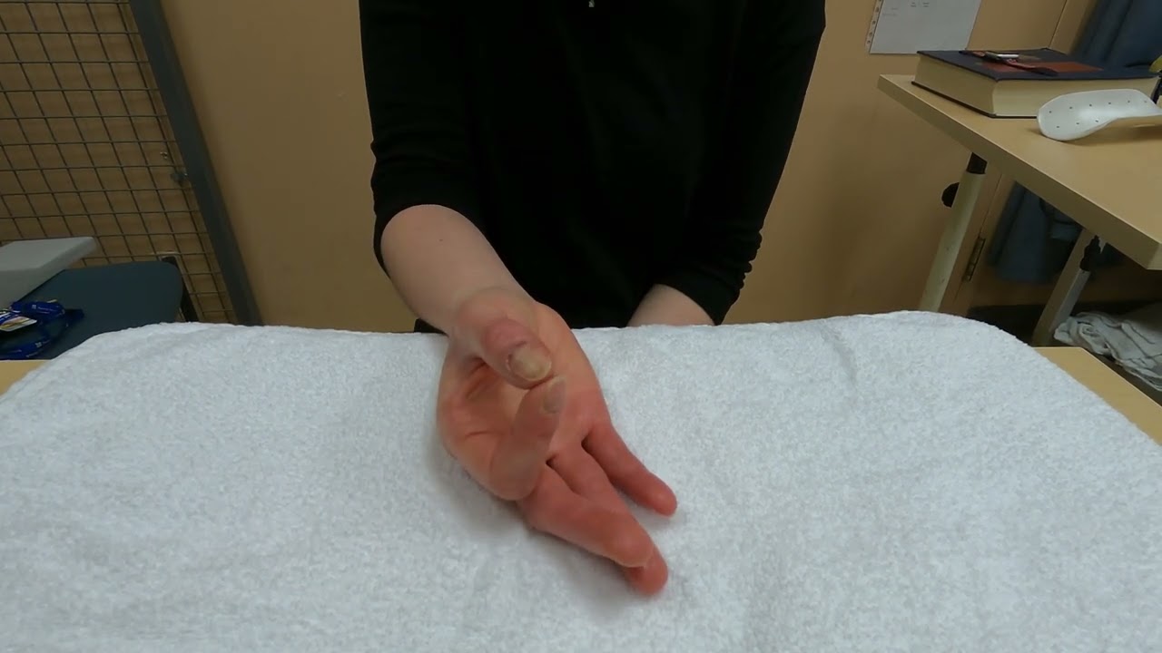 Hand injury exercise 14: Active thumb opposition - YouTube