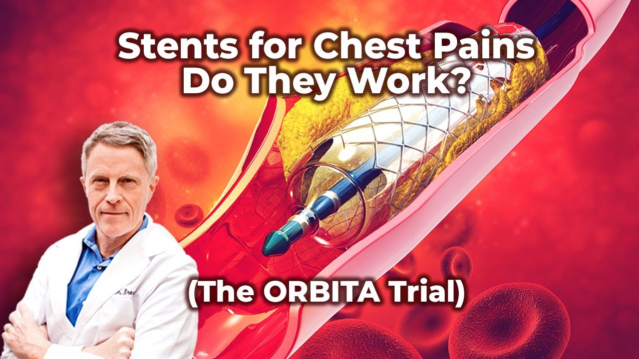 Stents for Chest Pains, Do They Work? (The ORBITA Trial) - YouTube