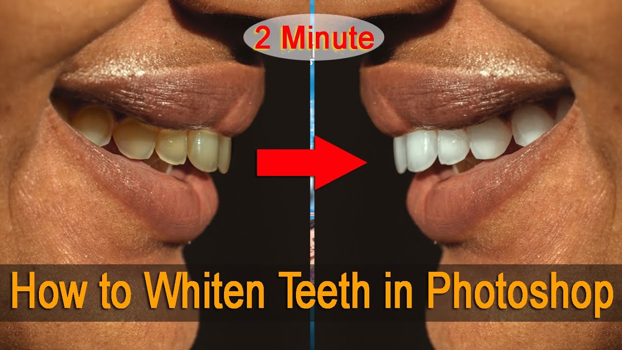 How to Whiten Teeth in Photoshop ||whiten teeth in photoshop||tutorial ...