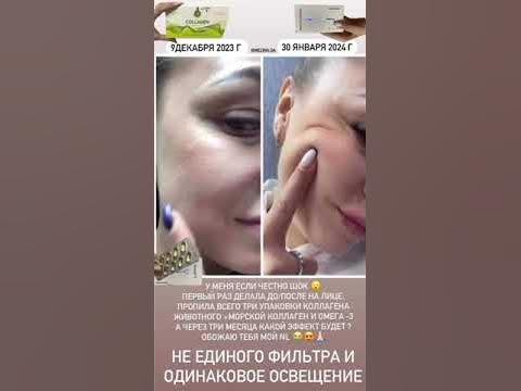ОТЗЫВ НА КОЛЛАГЕН NL 🥰 читай описание #nlinternational - YouTube