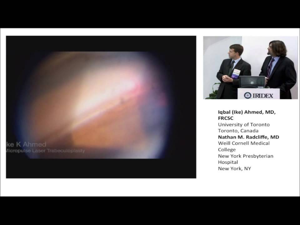Laser-Assisted, Non-Incisional Glaucoma Therapy - MLT - YouTube
