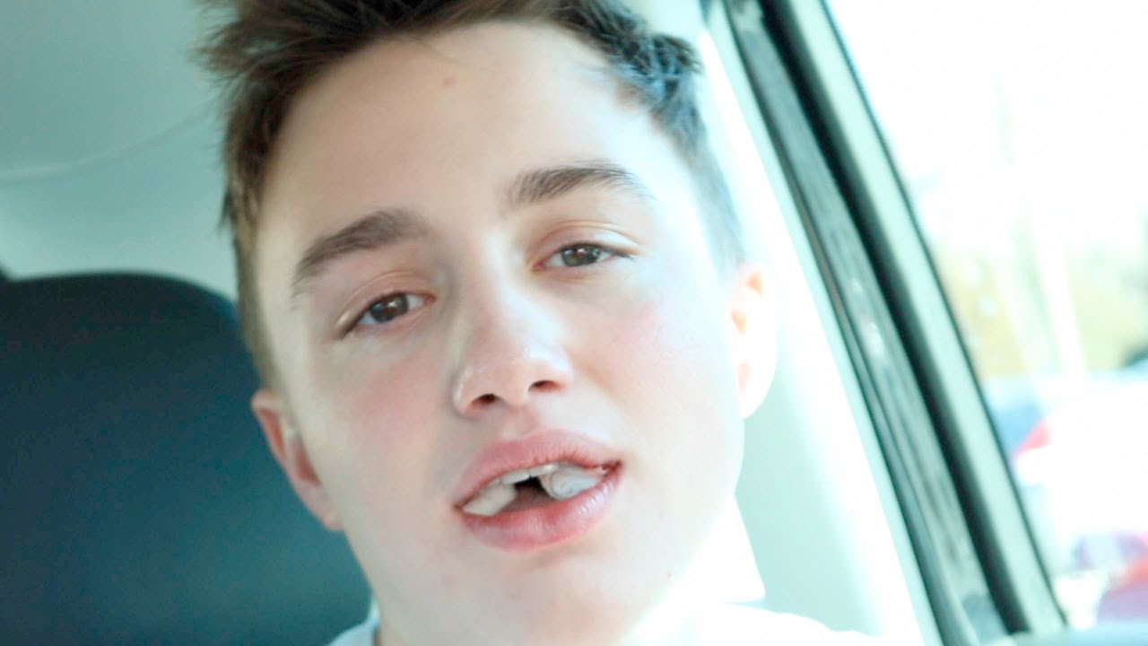 COMING OUT AFTER WISDOM TEETH SURGERY YouTube coming-out-after-wisdom-teeth-surgery-youtube