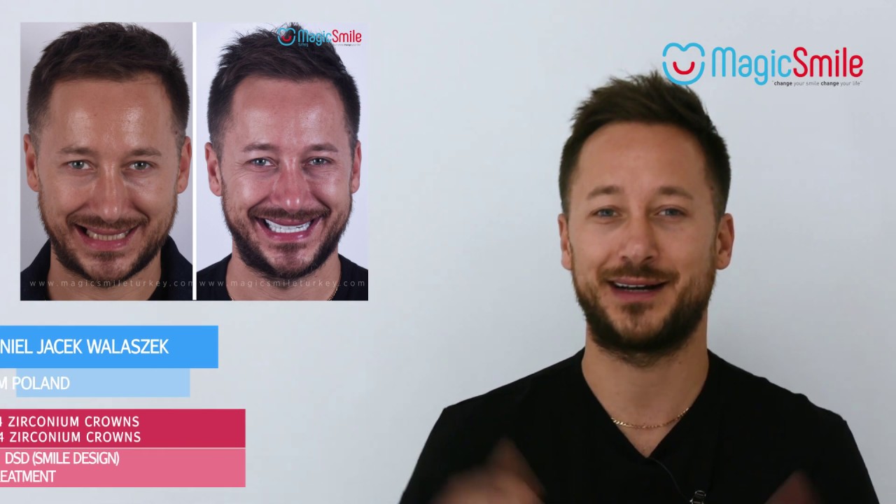 Magic Smile Turkey - Digital Smile Design Patient Review Daniel - YouTube