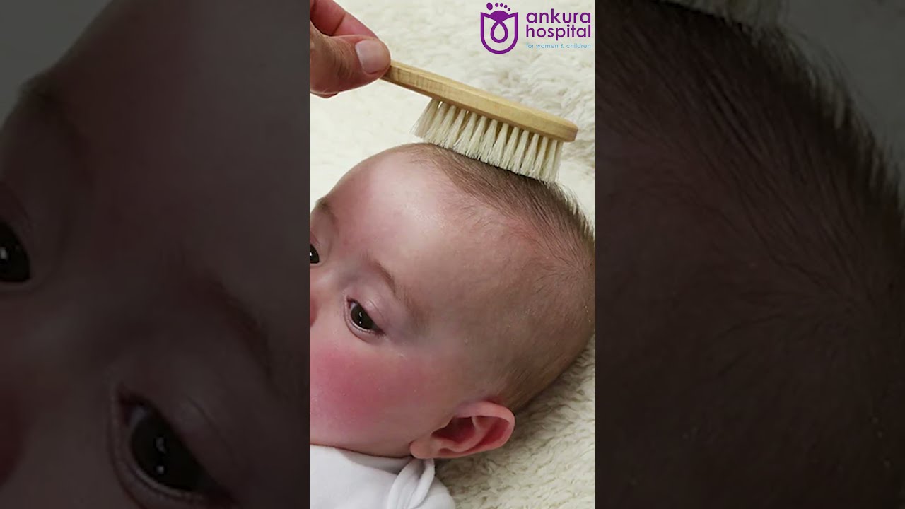 Curing cradle cap store