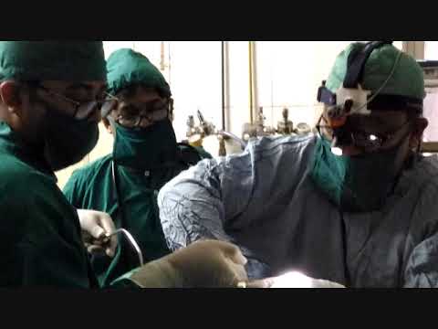 ENDOSCOPIC ADENOIDECTOMY - YouTube