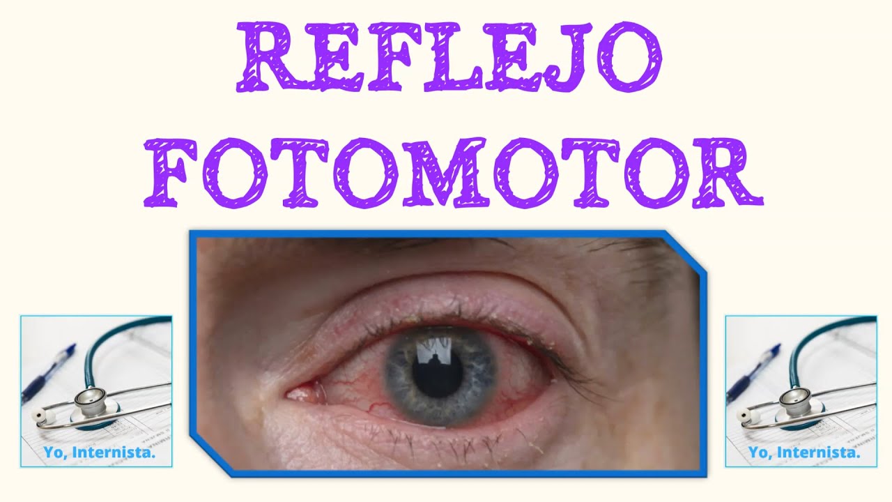 REFLEJO FOTOMOTOR - FACIL - YouTube