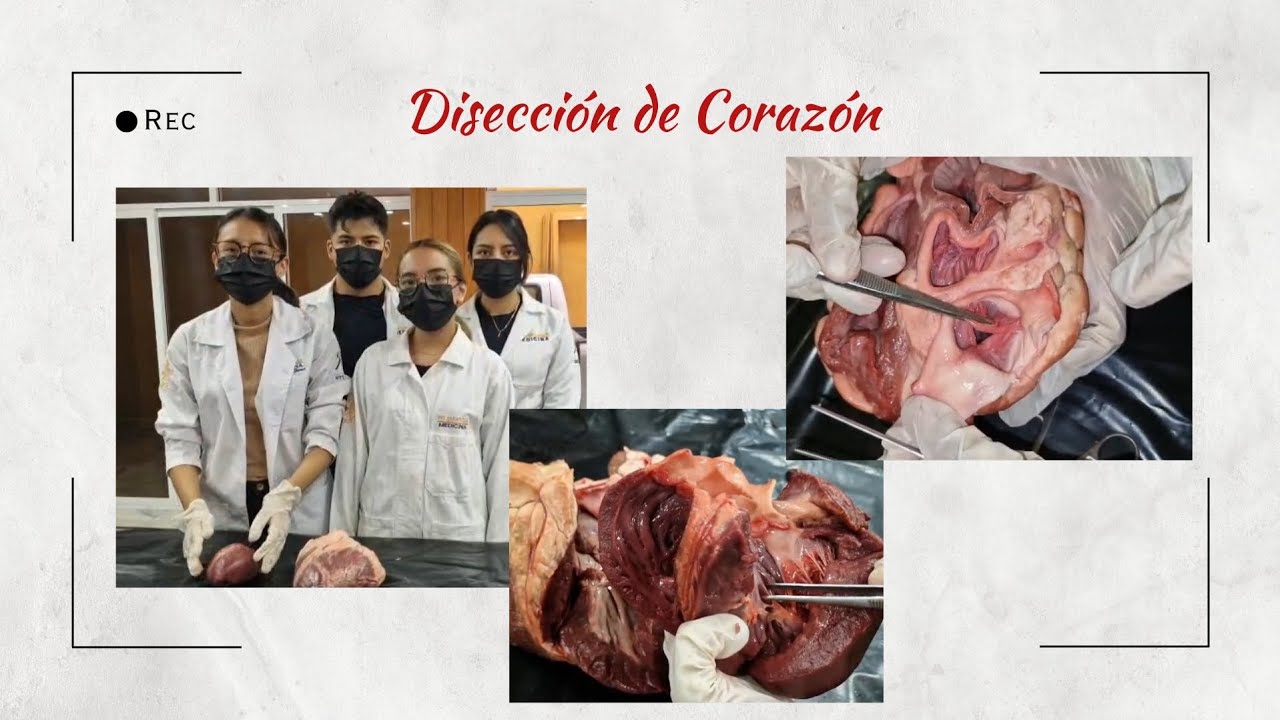 🫀 Disección de Corazón: Estructuras externas e internas 🫀 - YouTube