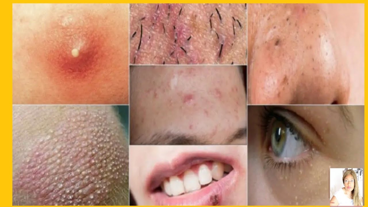 NE TOUCHEZ SURTOUT PAS À CE TYPE DE BOUTONS:Voici Pourquoi Des Boutons ...