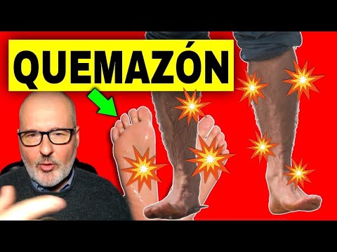 10 CAUSAS de ARDOR en PIERNAS y PIES