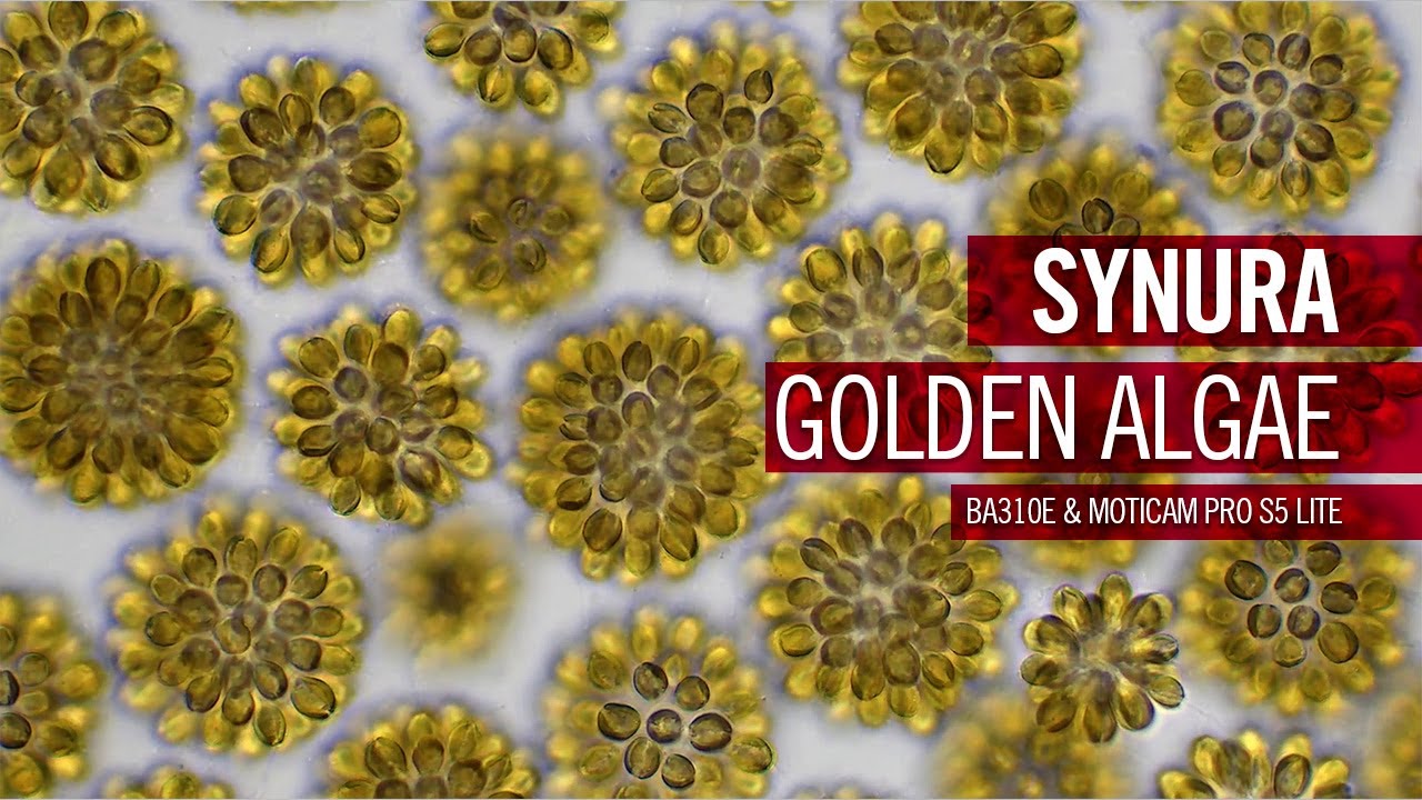Golden Algae Protist
