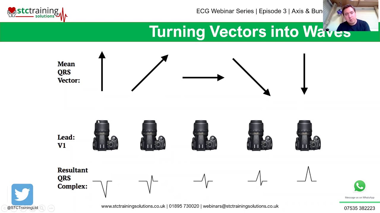 ECG Webinar Series | Episode 3 | Axis & Bundle Branch Blocks - YouTube