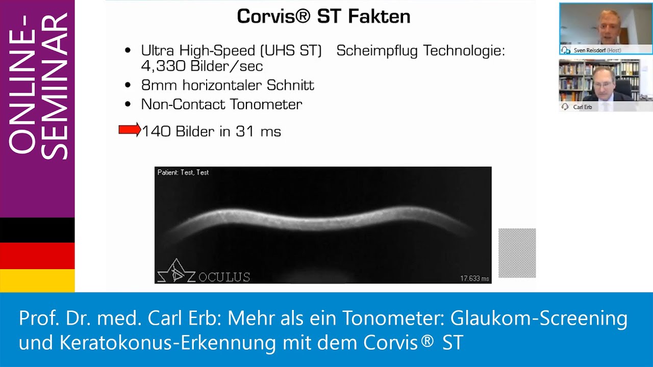 Mehr als ein Tonometer: Glaukom-Screening und Keratokonus-Erkennung mit ...