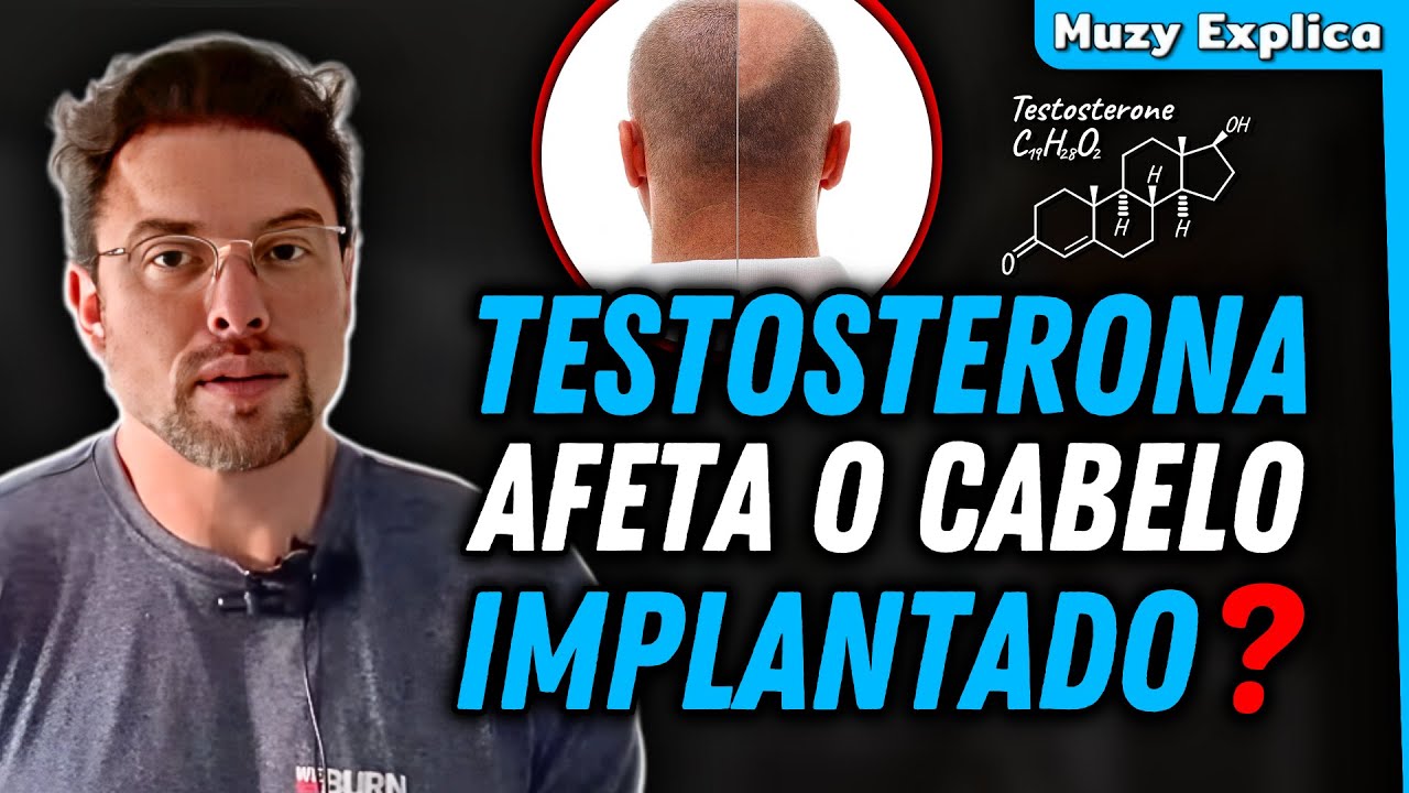 Uso de TESTOSTERONA causa QUEDA DE CABELO IMPLANTADO também? | Muzy ...