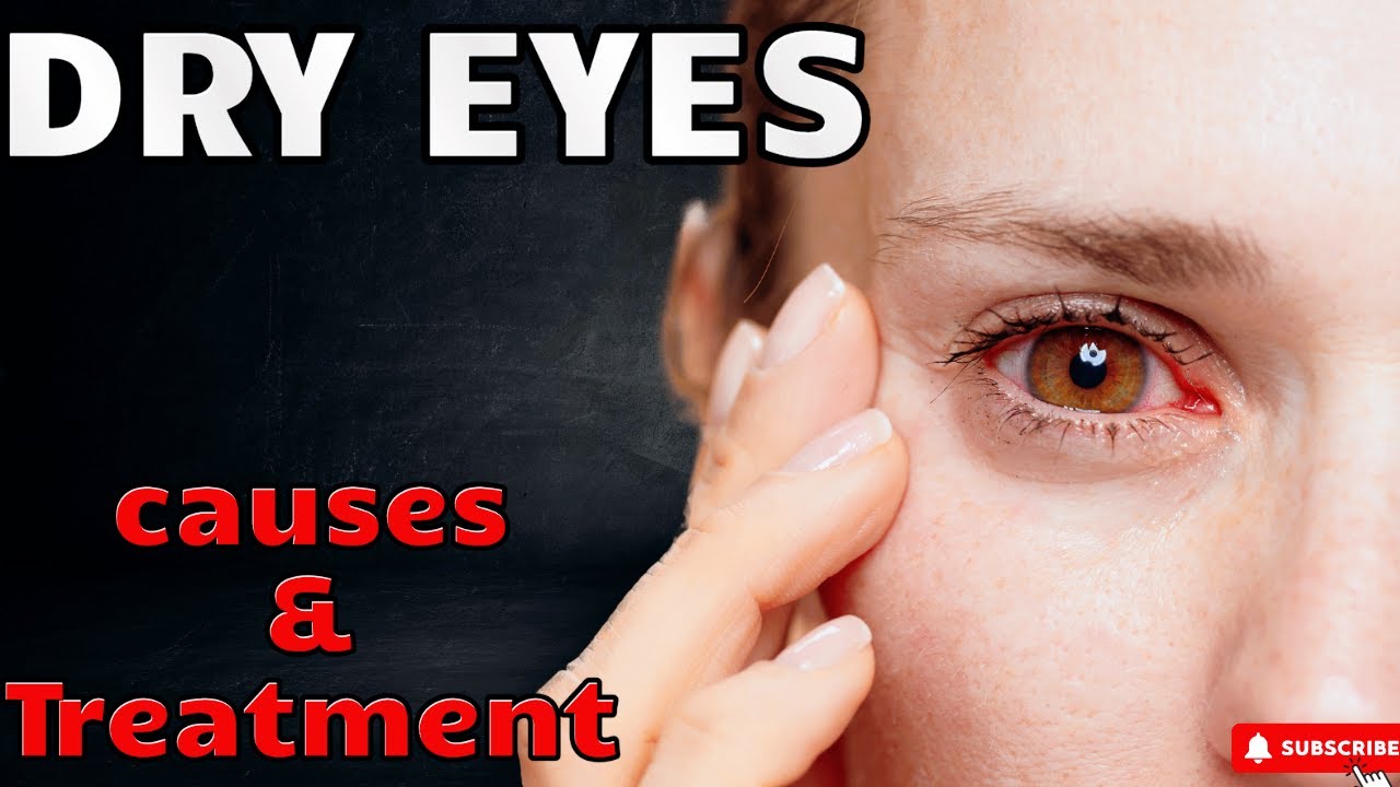 7 most common causes of Dry Eyes and treatment you can do at home ...