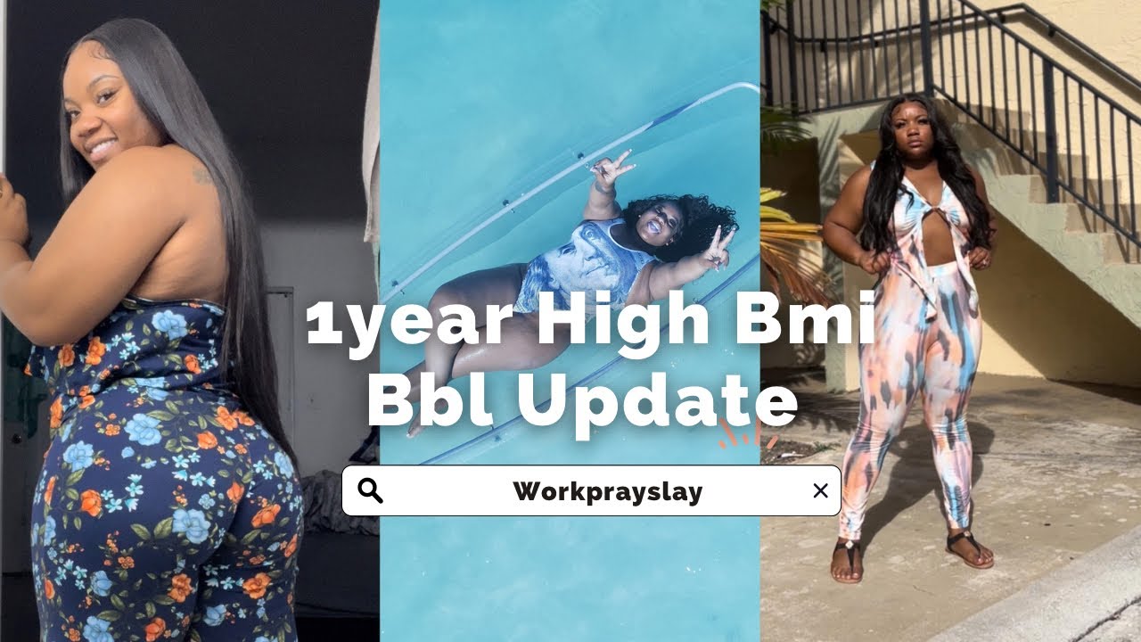 1 Year BBL High BMI - YouTube
