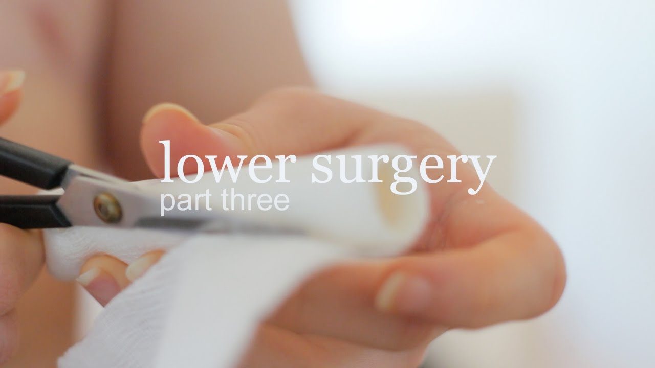 One Week post Metoidioplasty | FTM - YouTube