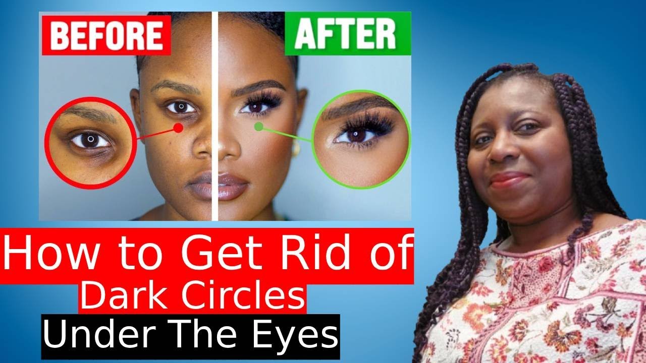 How To Get Rid of Dark Circles Under The Eyes | 3 Easy To Do Home ...