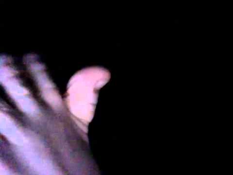 My 16 Year Old Foot (I'm still here btw)