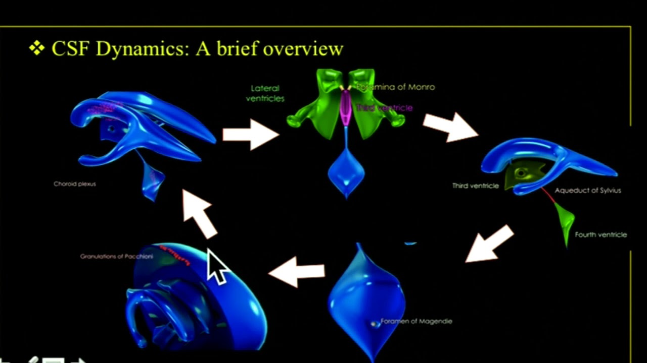 TMT: CSF FLOW DYNAMICS ON MRI- Part I - YouTube