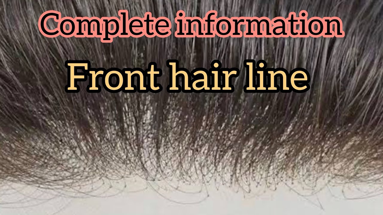 Front hair line patch complete information - YouTube