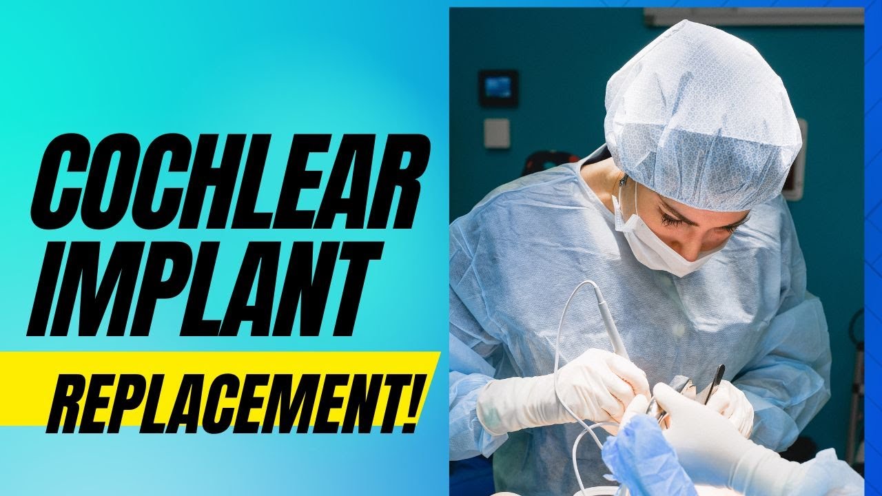Cochlear Implant Replacement Story - YouTube
