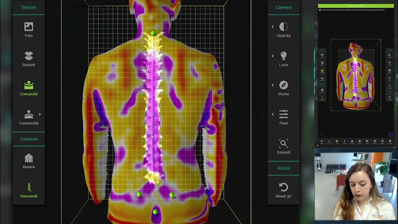 Spine3D Demo Software Sensor Medica - YouTube