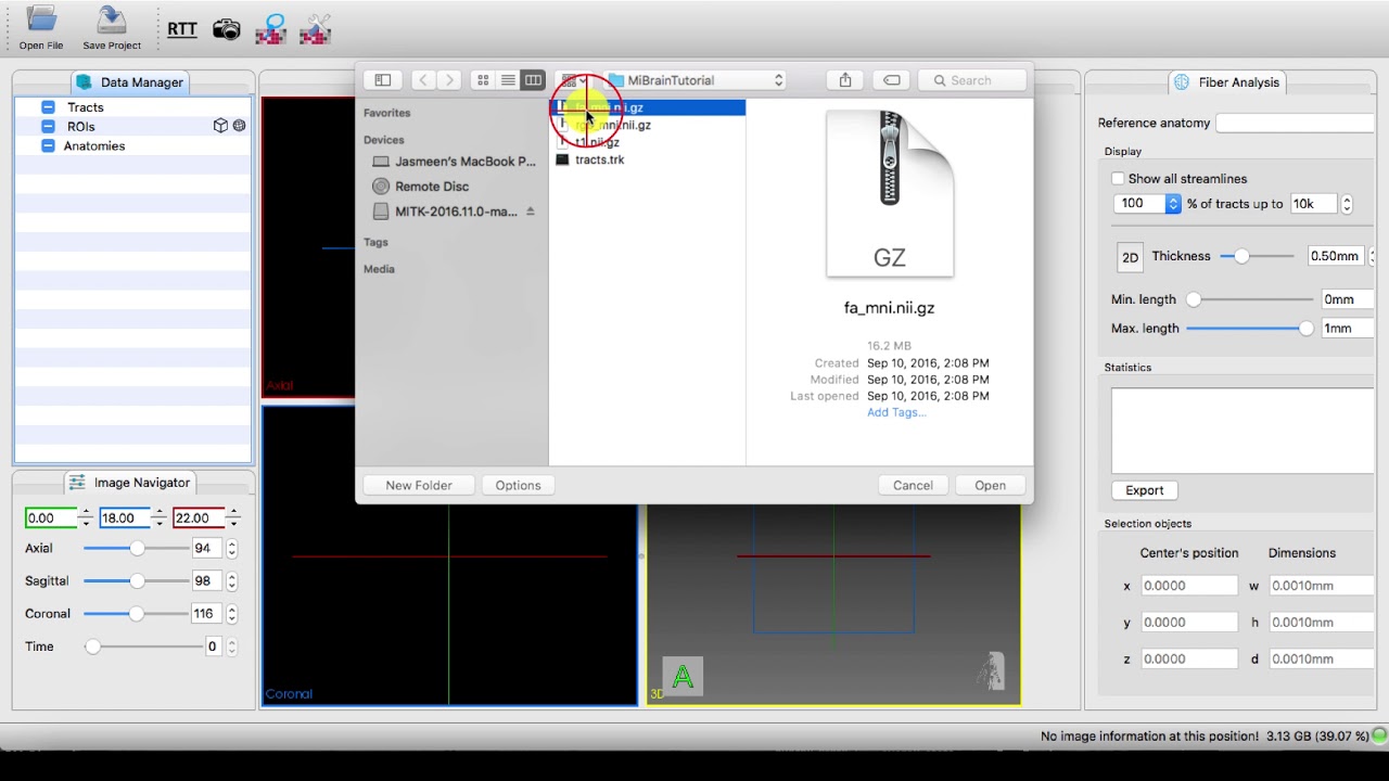 MI-Brain - Open an anatomy - YouTube